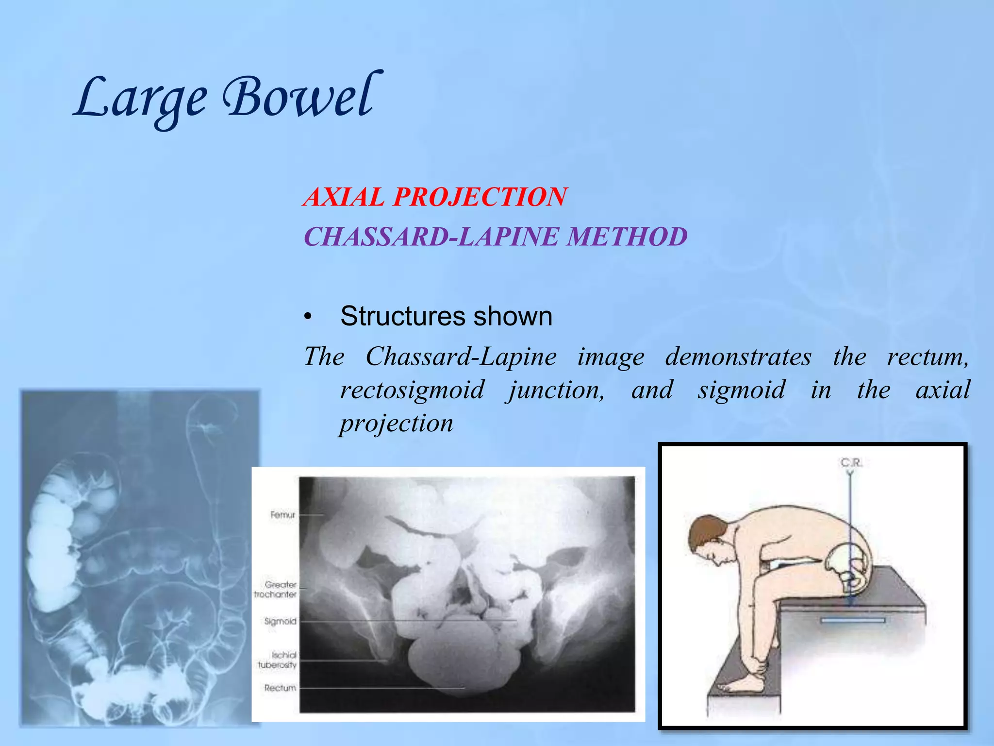 Digestive system imaging 3 class | PPTX