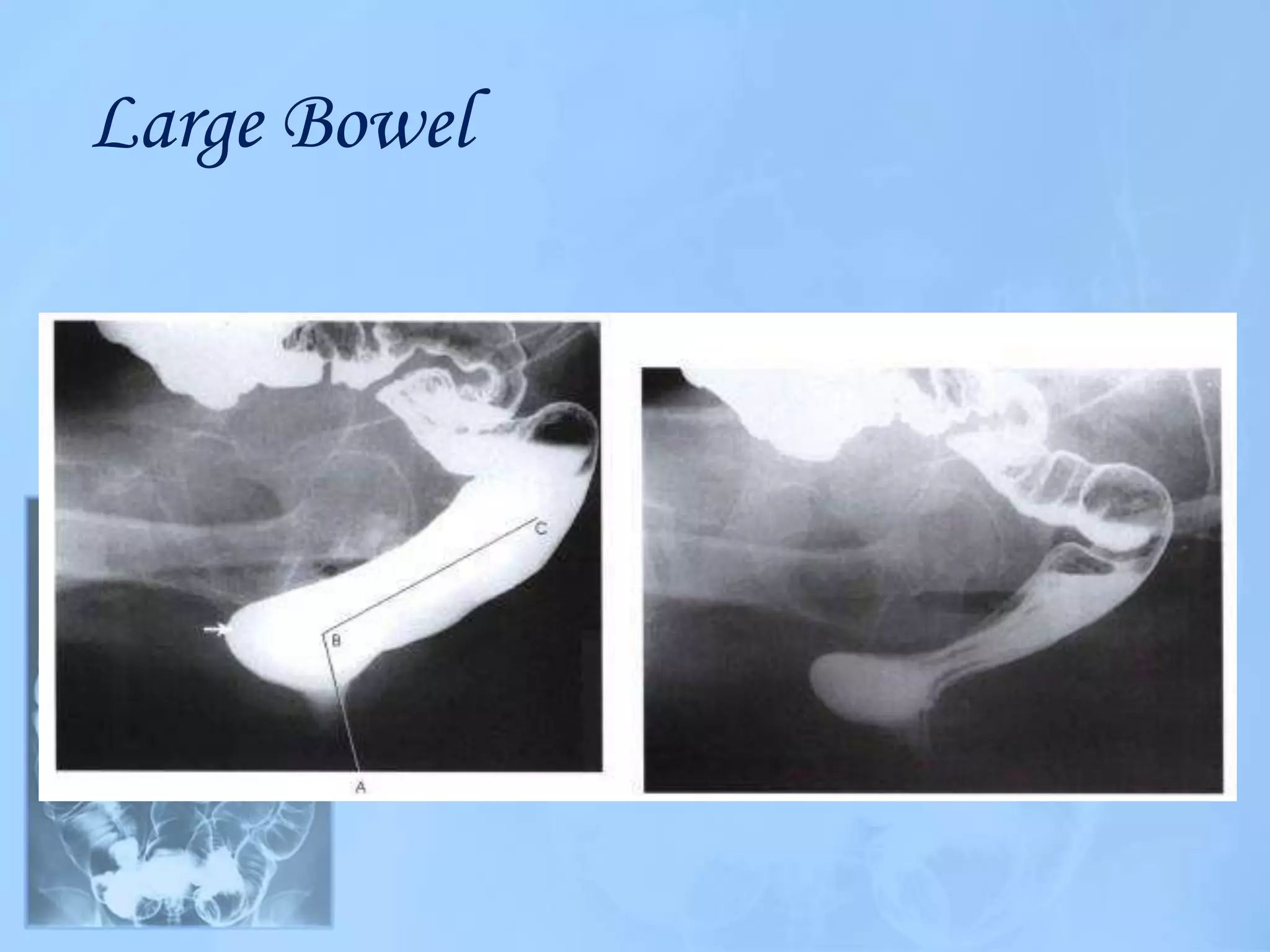 Digestive system imaging 3 class | PPTX