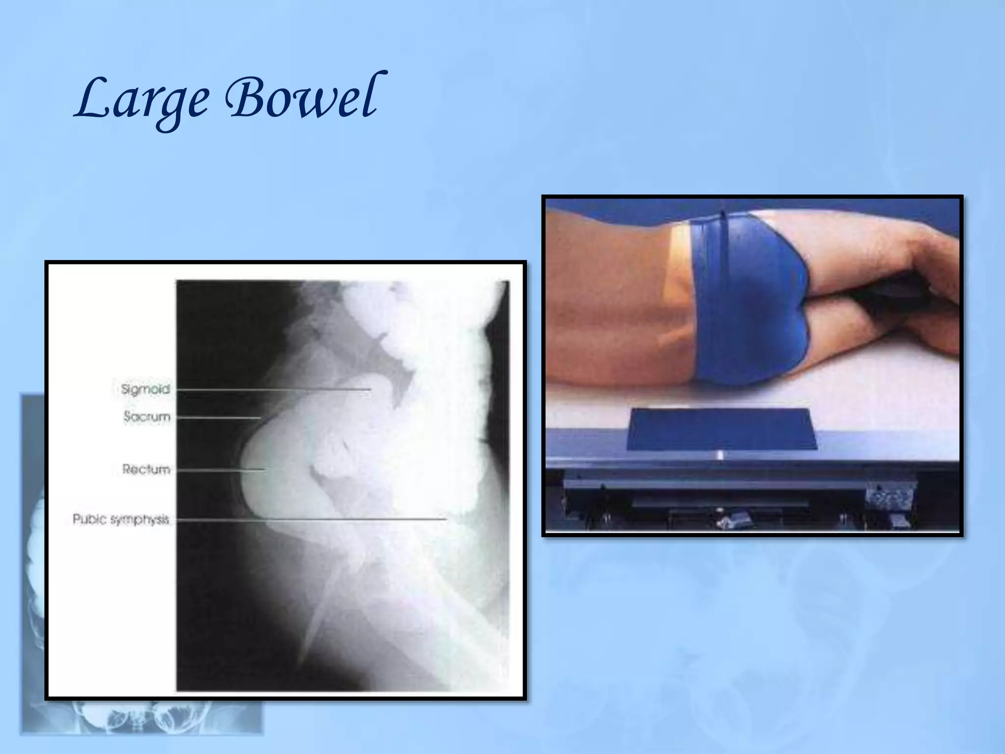 Digestive system imaging 3 class | PPTX