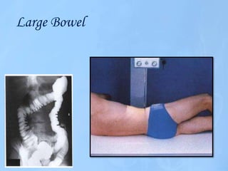 Digestive system imaging 3 class | PPTX