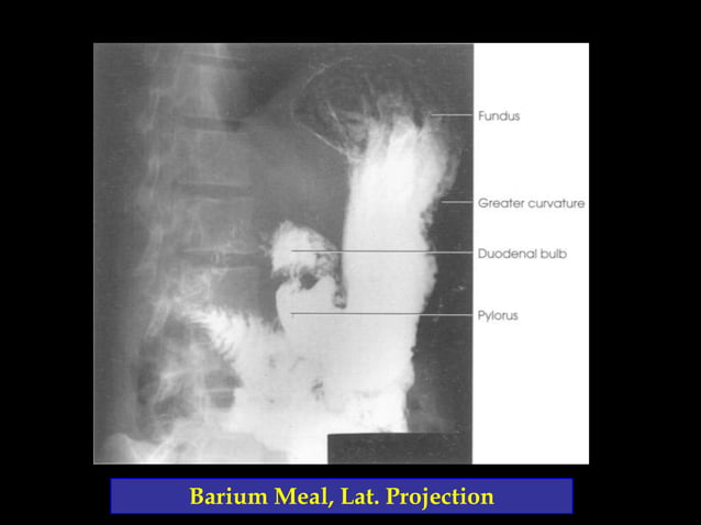 Digestive system radiography | PPSX