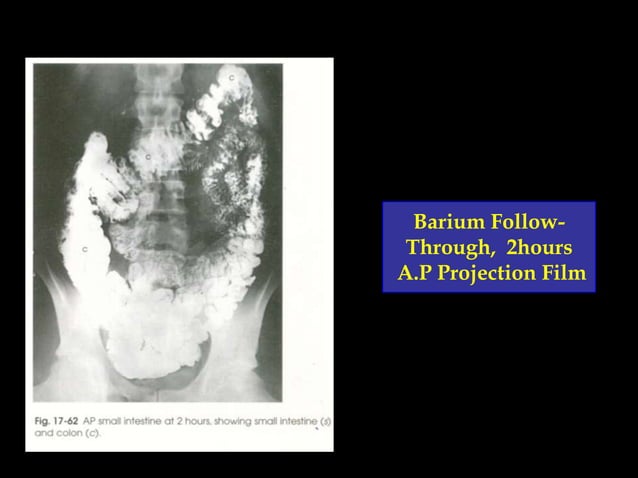 Digestive system radiography | PPSX