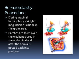 Digestive system terms | PPTX