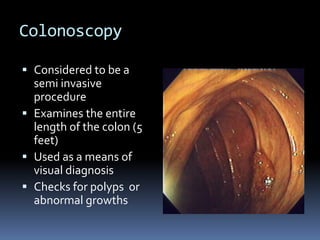 Digestive system terms | PPTX