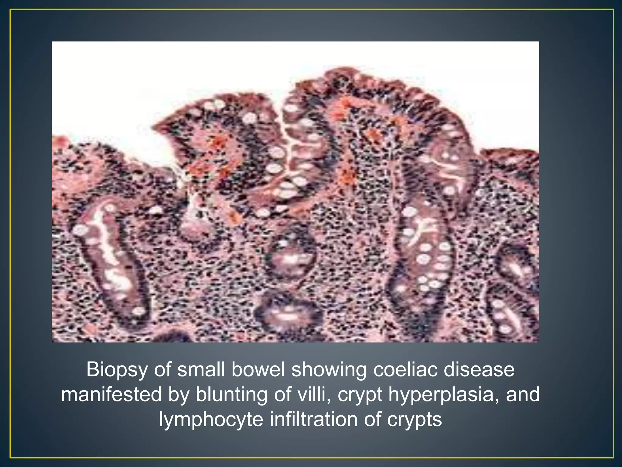 Digestive tract (Histology) | PPTX