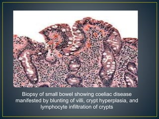 Digestive tract (Histology) | PPTX