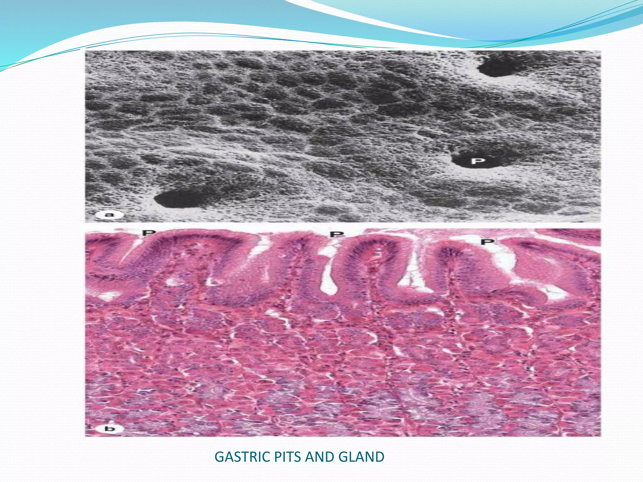Digestive tract ppt | PPTX | Digestive Disorders | Diseases and Conditions