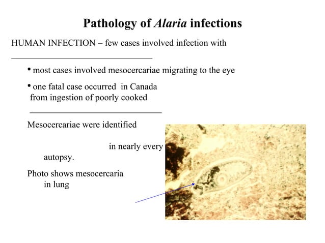 Digestive Trematodes | PPT | Infectious Diseases | Diseases and Conditions