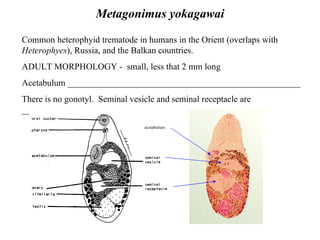 Heterophyes Heterophyes Egg Label