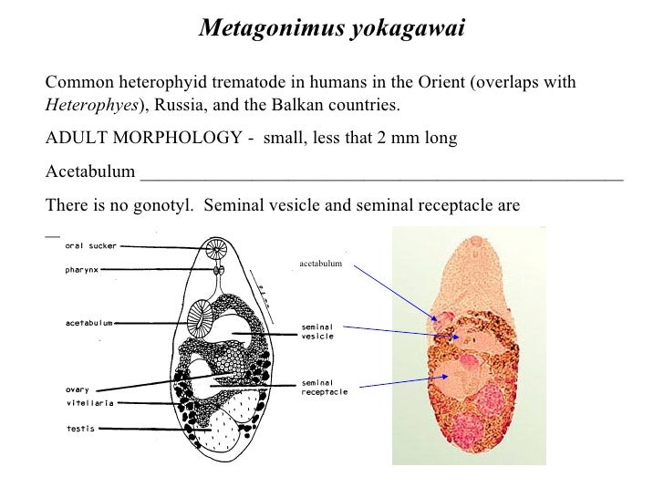 Digestive Trematodes