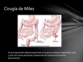 Digestivo bajo | PPTX