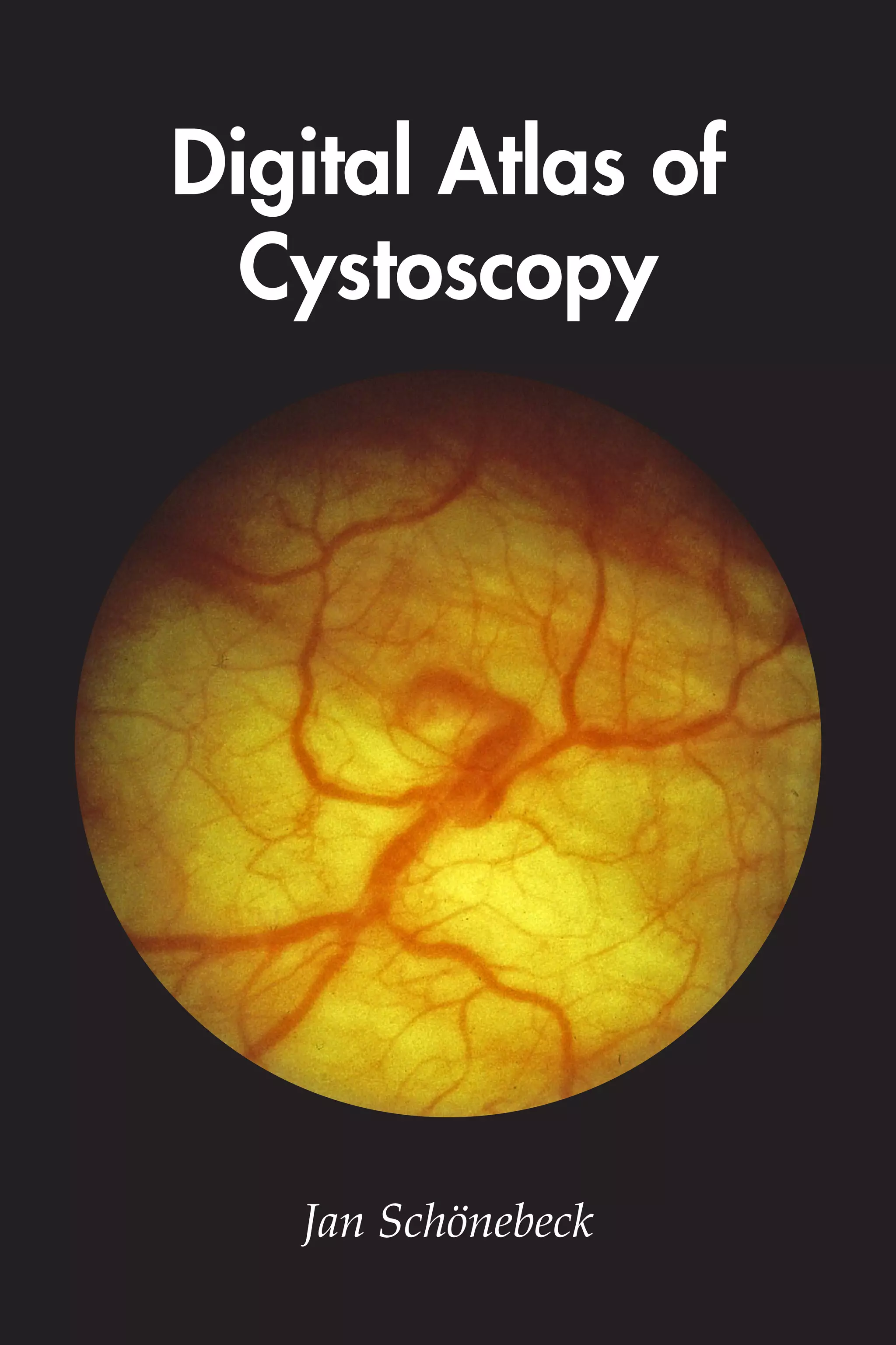 Digital atlas of cystoscopy.pdf