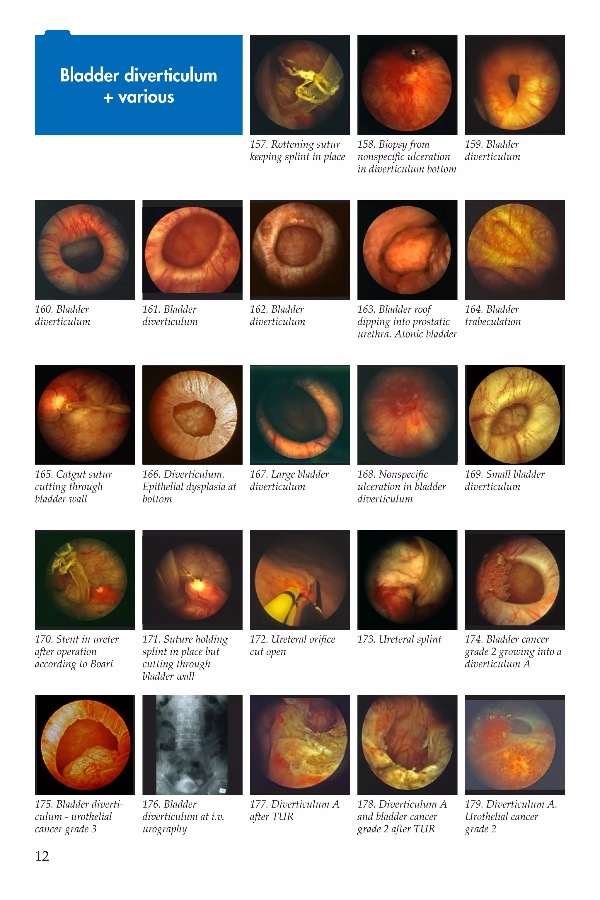 Digital atlas of cystoscopy.pdf
