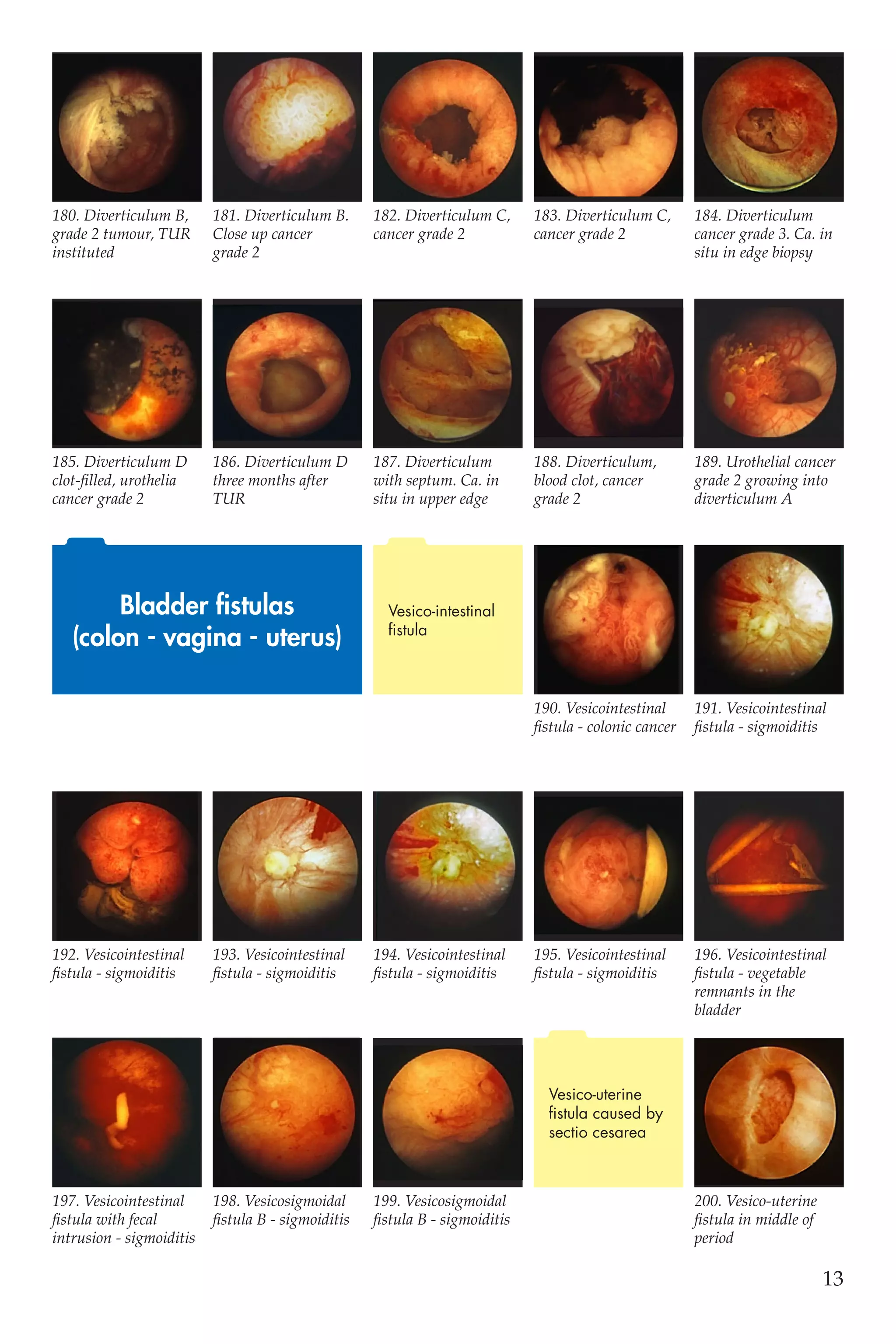 Digital atlas of cystoscopy.pdf