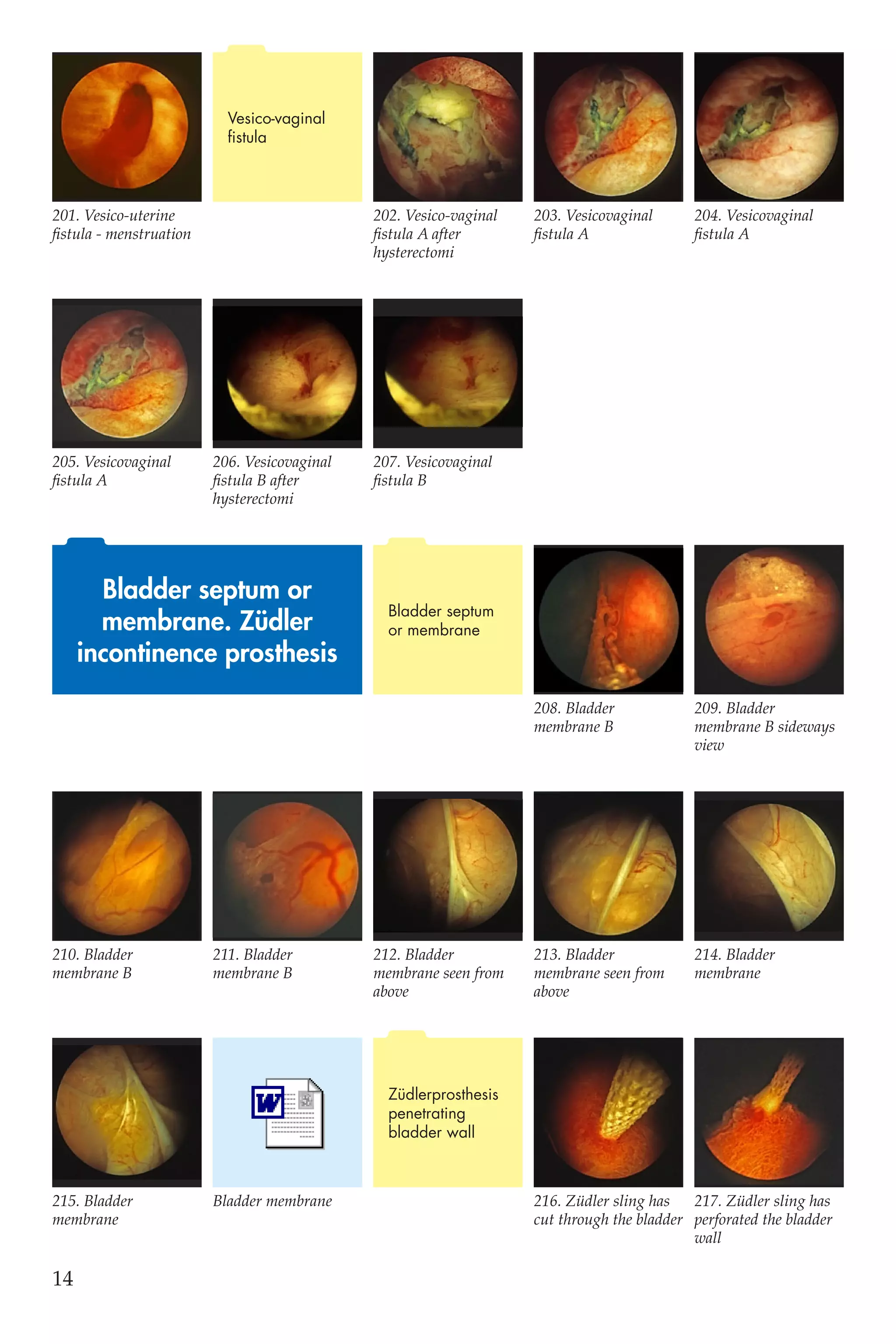 Digital atlas of cystoscopy.pdf