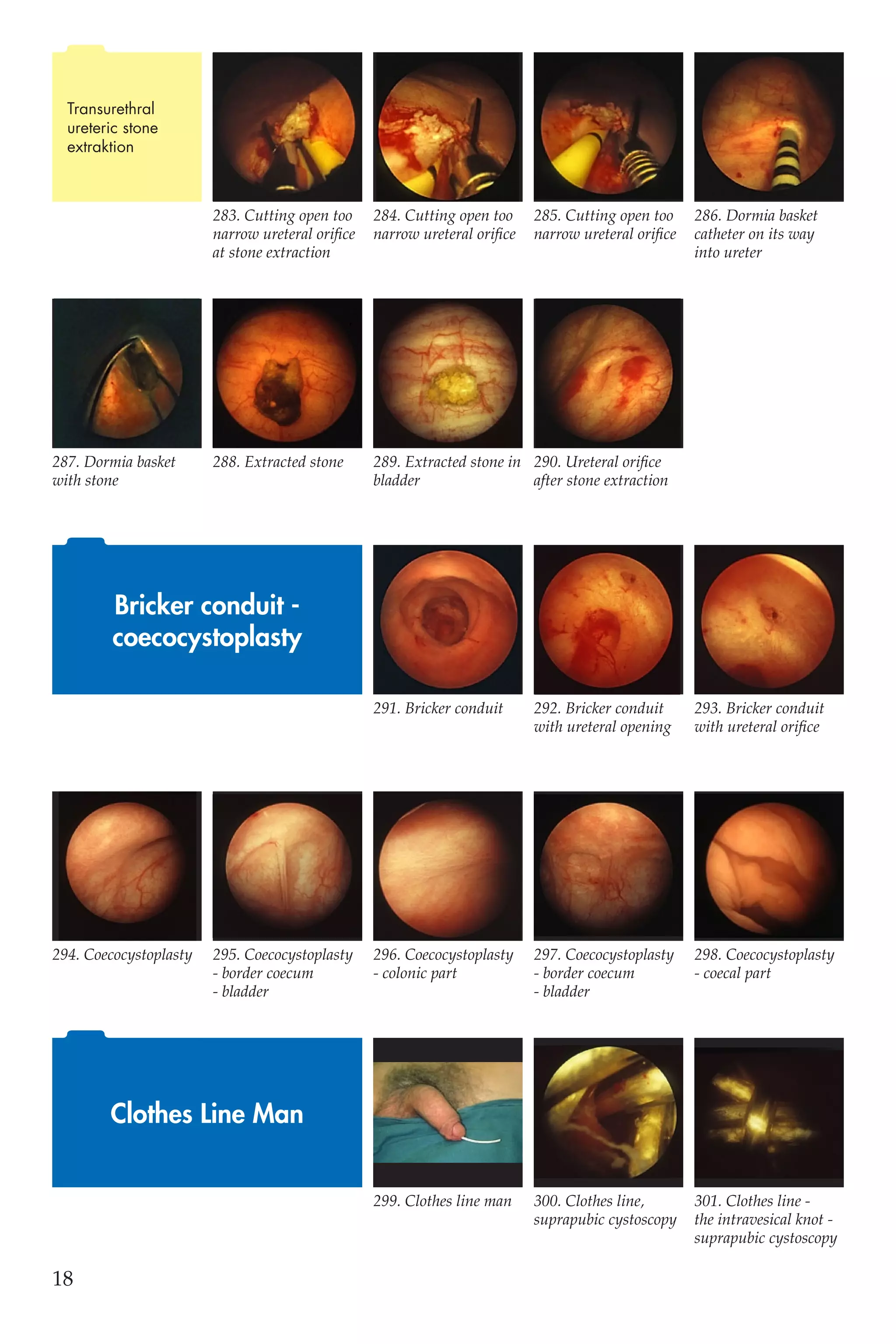 Digital atlas of cystoscopy.pdf
