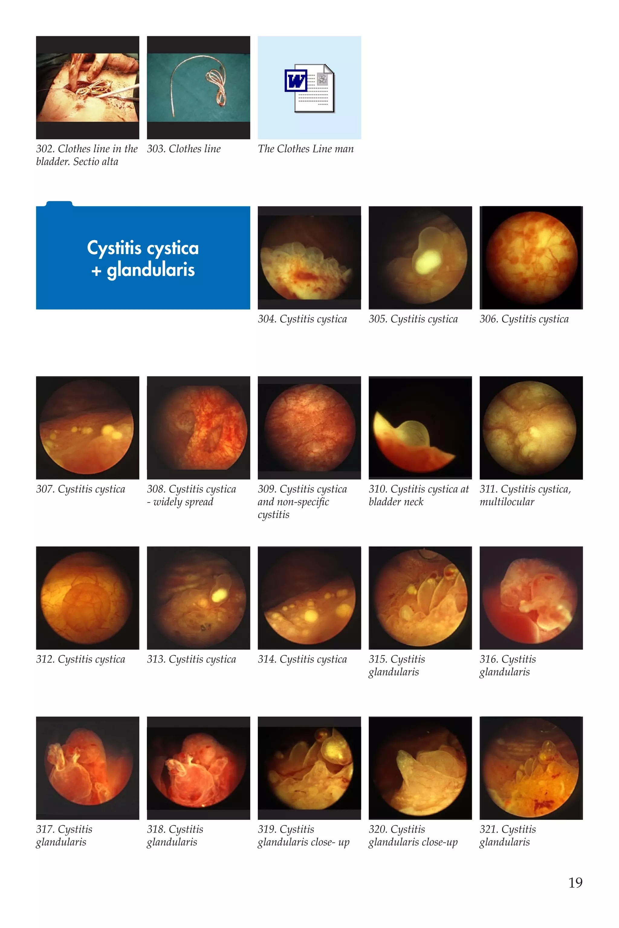 Digital atlas of cystoscopy.pdf