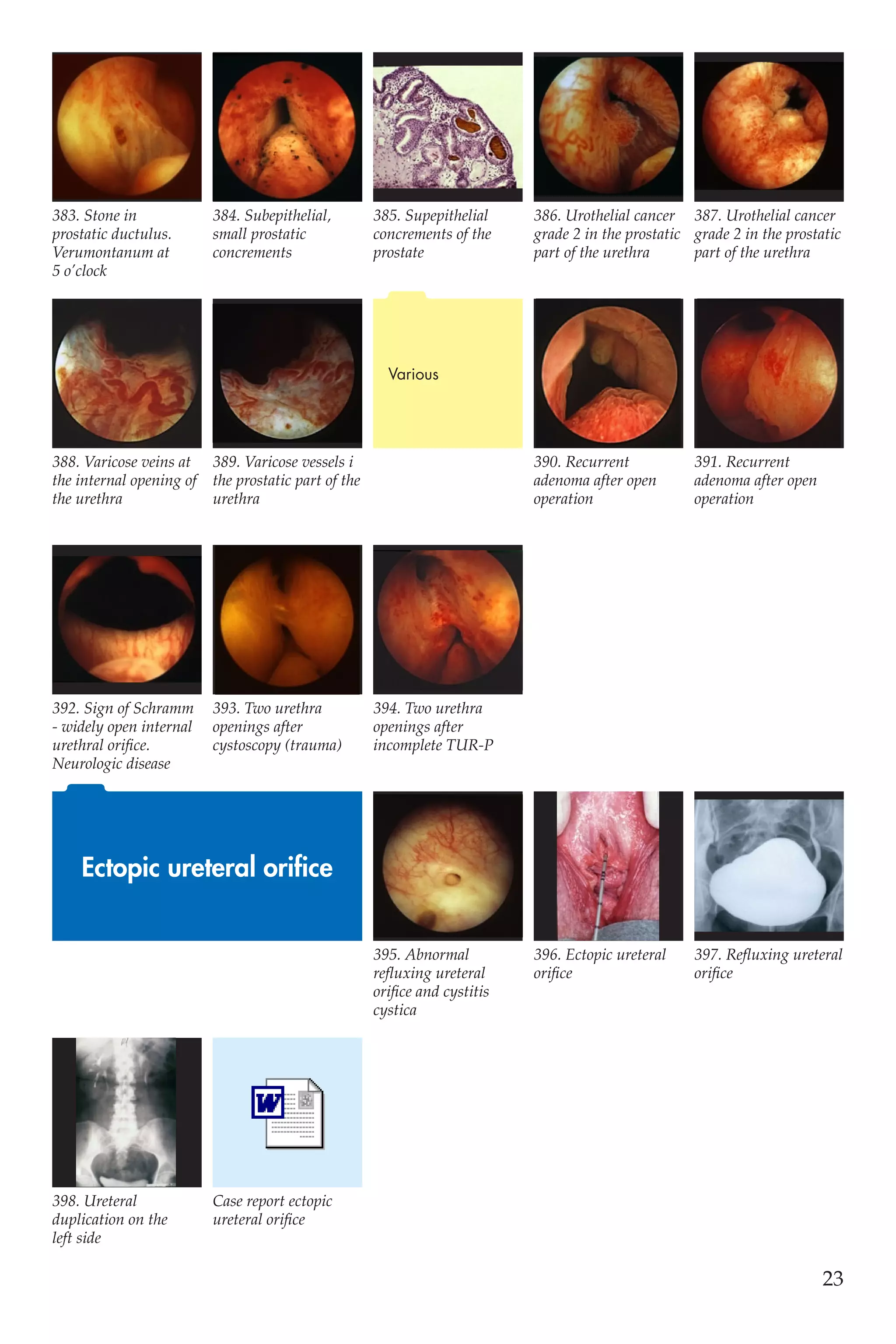 Digital atlas of cystoscopy.pdf
