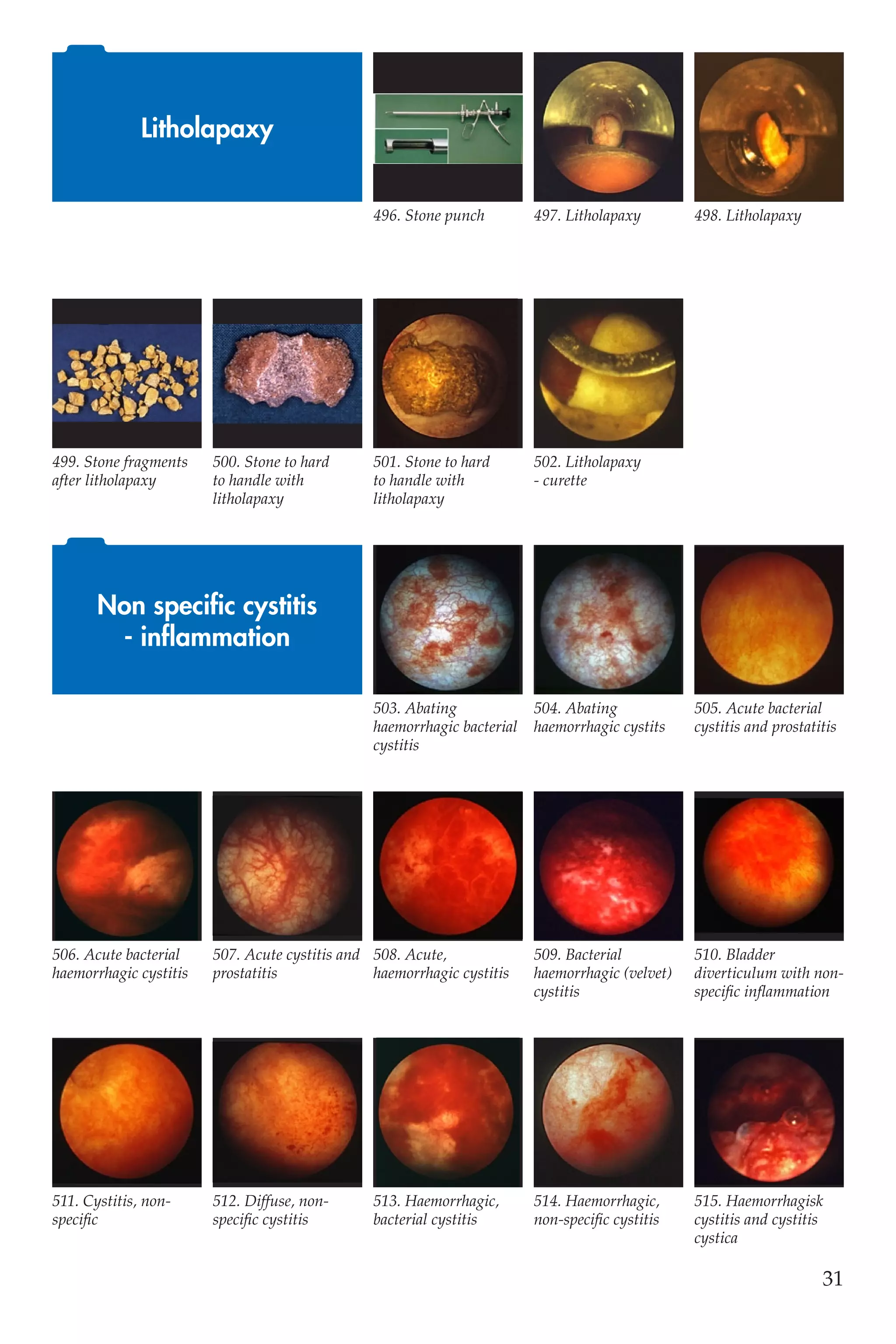 Digital atlas of cystoscopy.pdf
