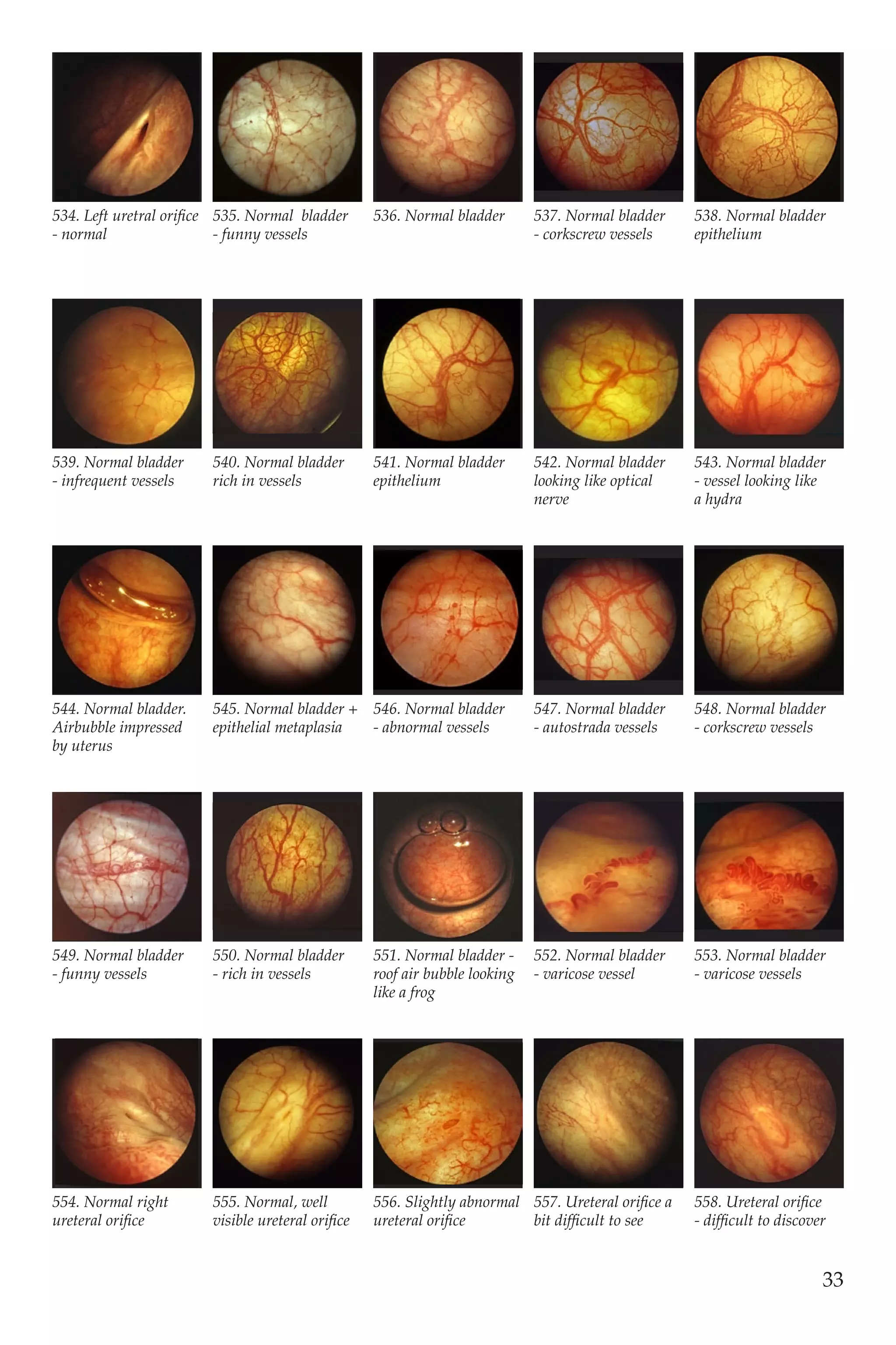 Digital atlas of cystoscopy.pdf