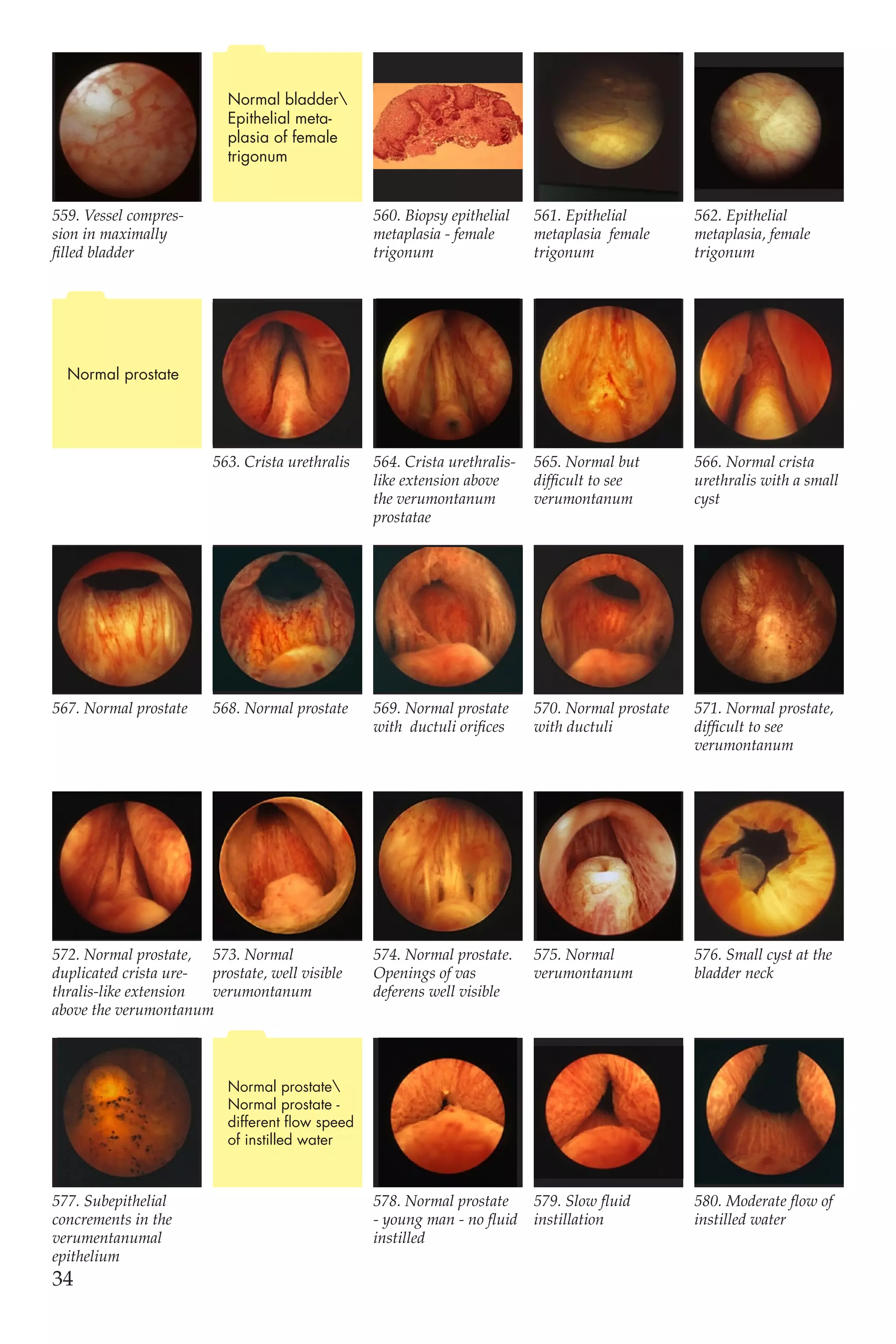 Digital atlas of cystoscopy.pdf