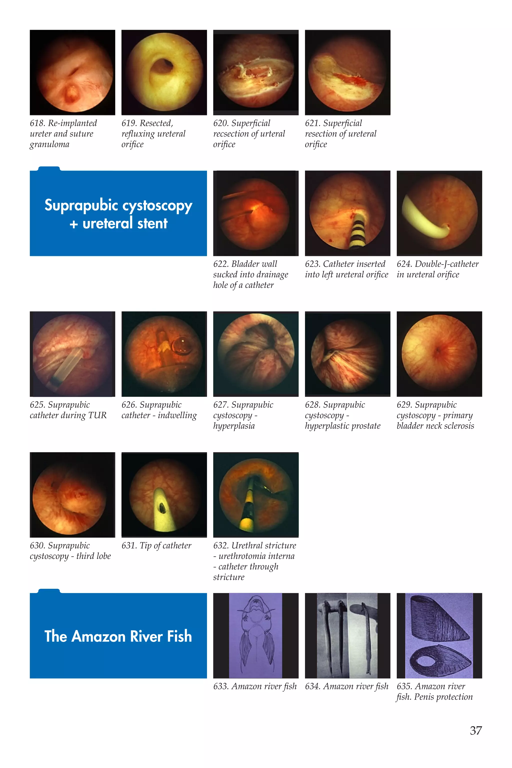 Digital atlas of cystoscopy.pdf