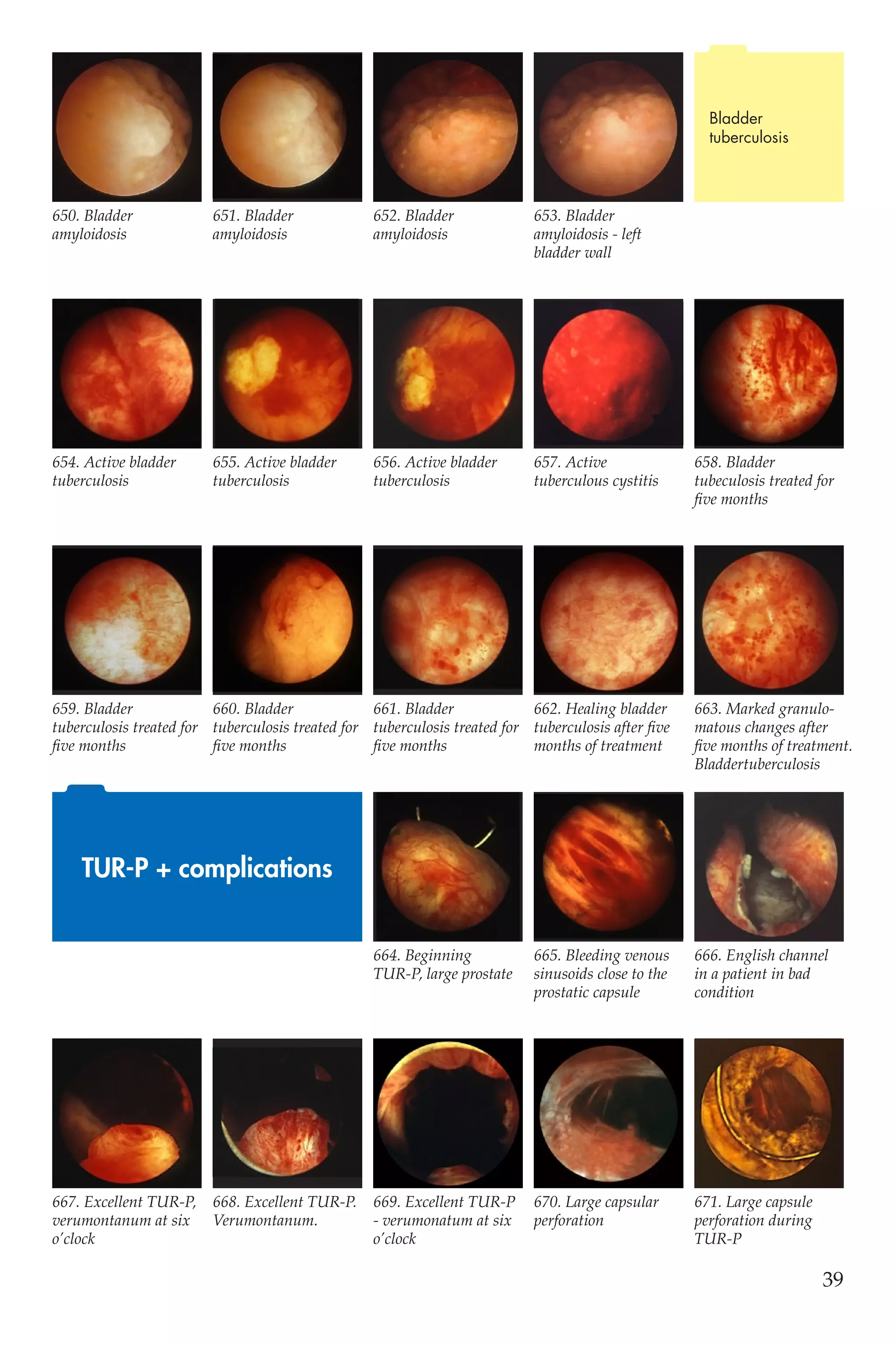 Digital atlas of cystoscopy.pdf