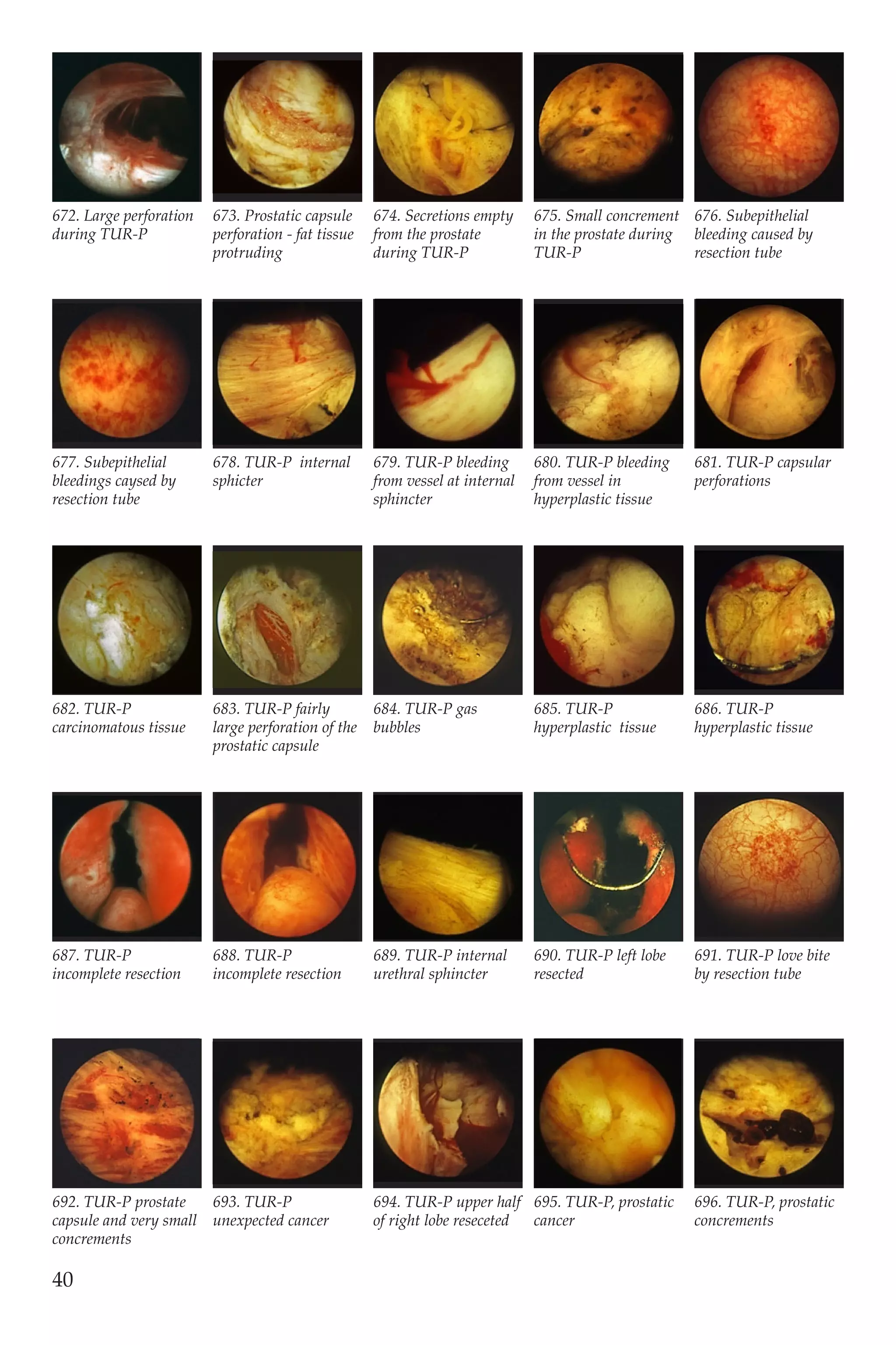 Digital atlas of cystoscopy.pdf