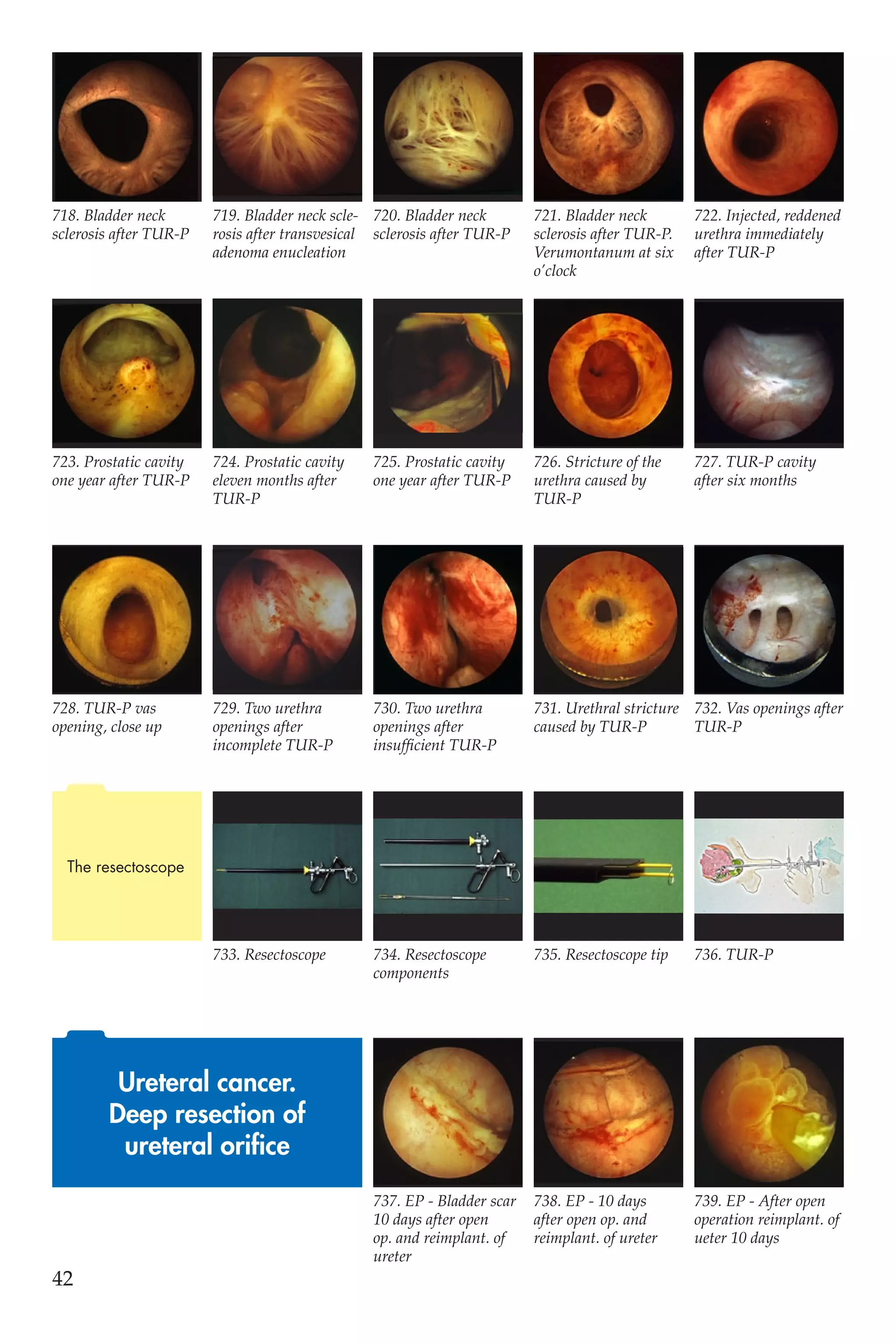 Digital atlas of cystoscopy.pdf
