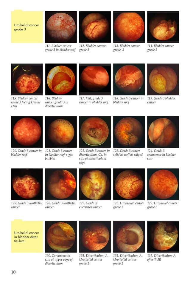 Digital atlas of cystoscopy.pdf