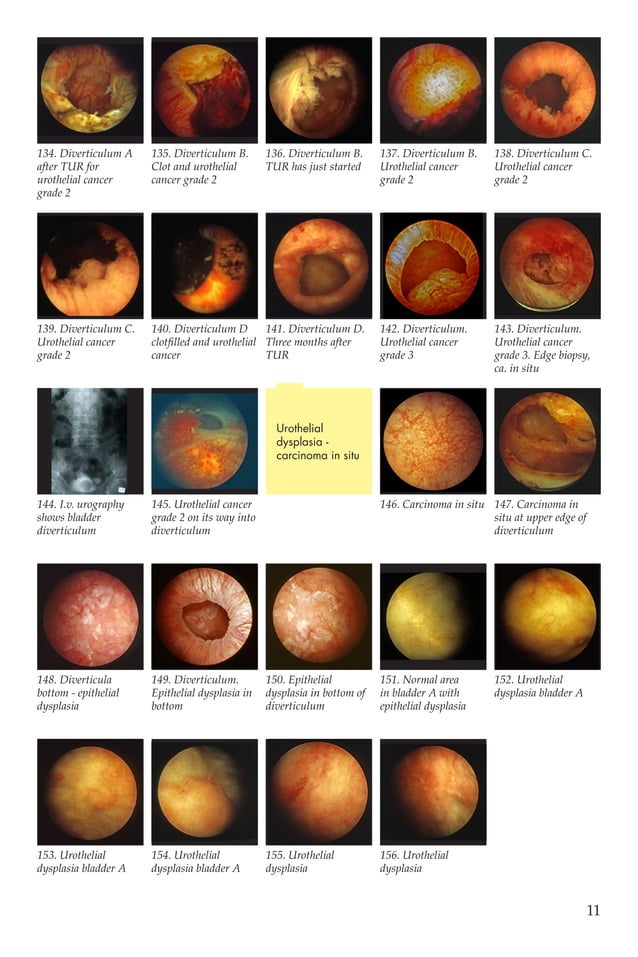 Digital atlas of cystoscopy.pdf