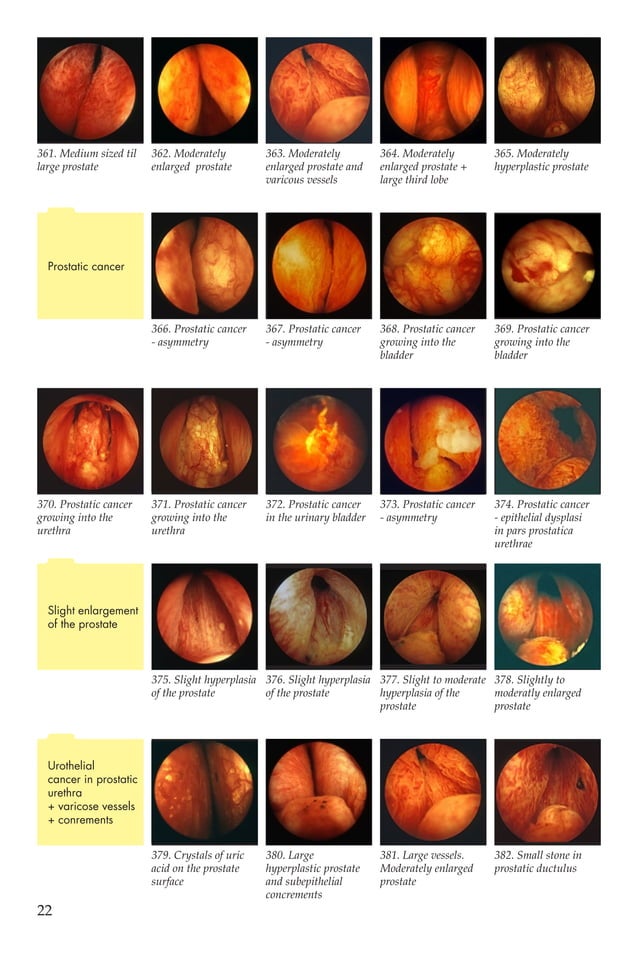 Digital atlas of cystoscopy.pdf