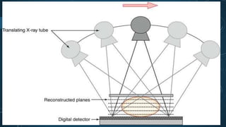 Digital breast tomosynthesis | PPTX