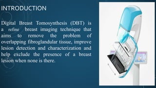 Digital breast tomosynthesis | PPTX