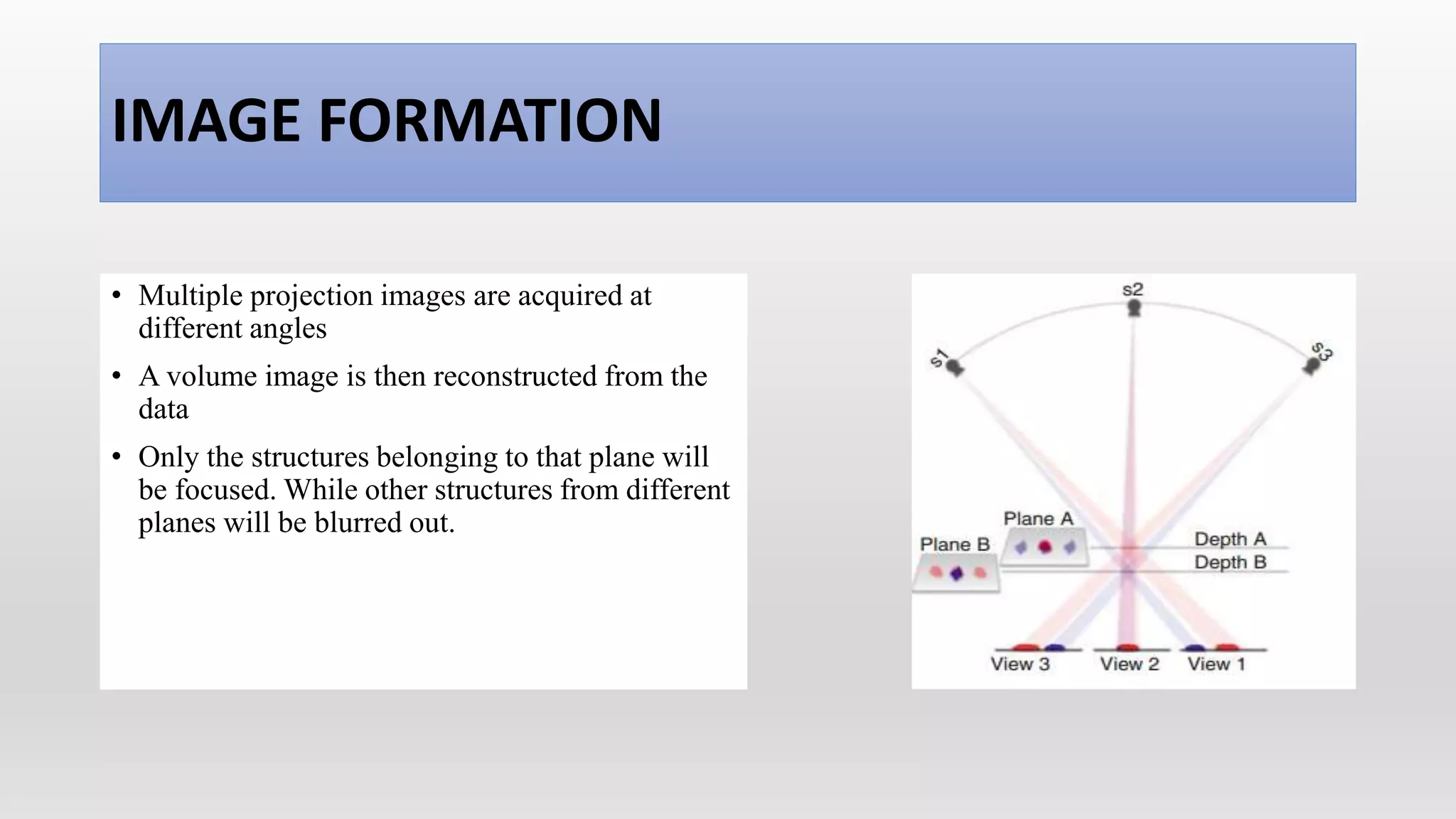Digital breast tomosynthesis | PPTX