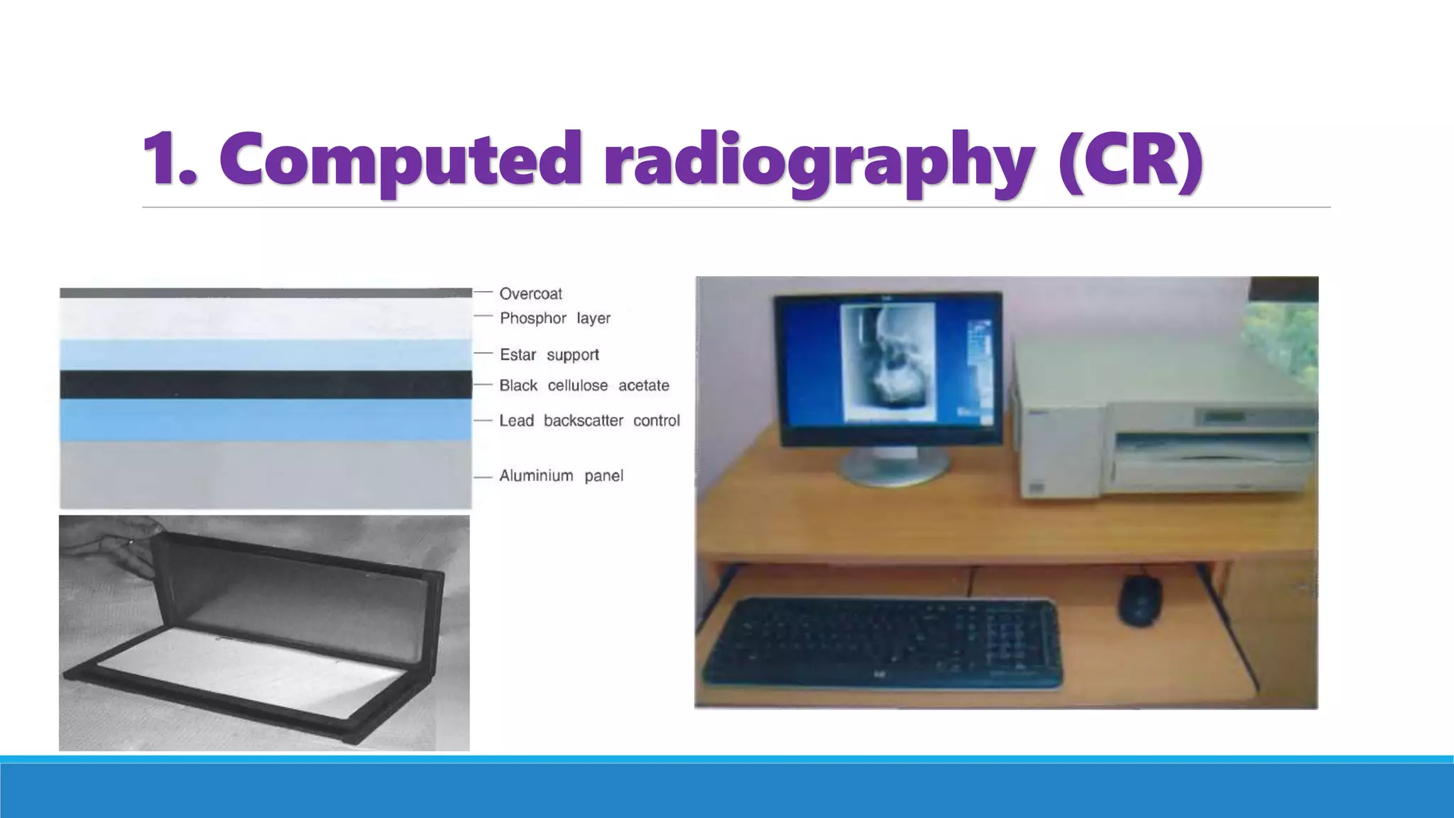 Digital cephalometry | PPTX