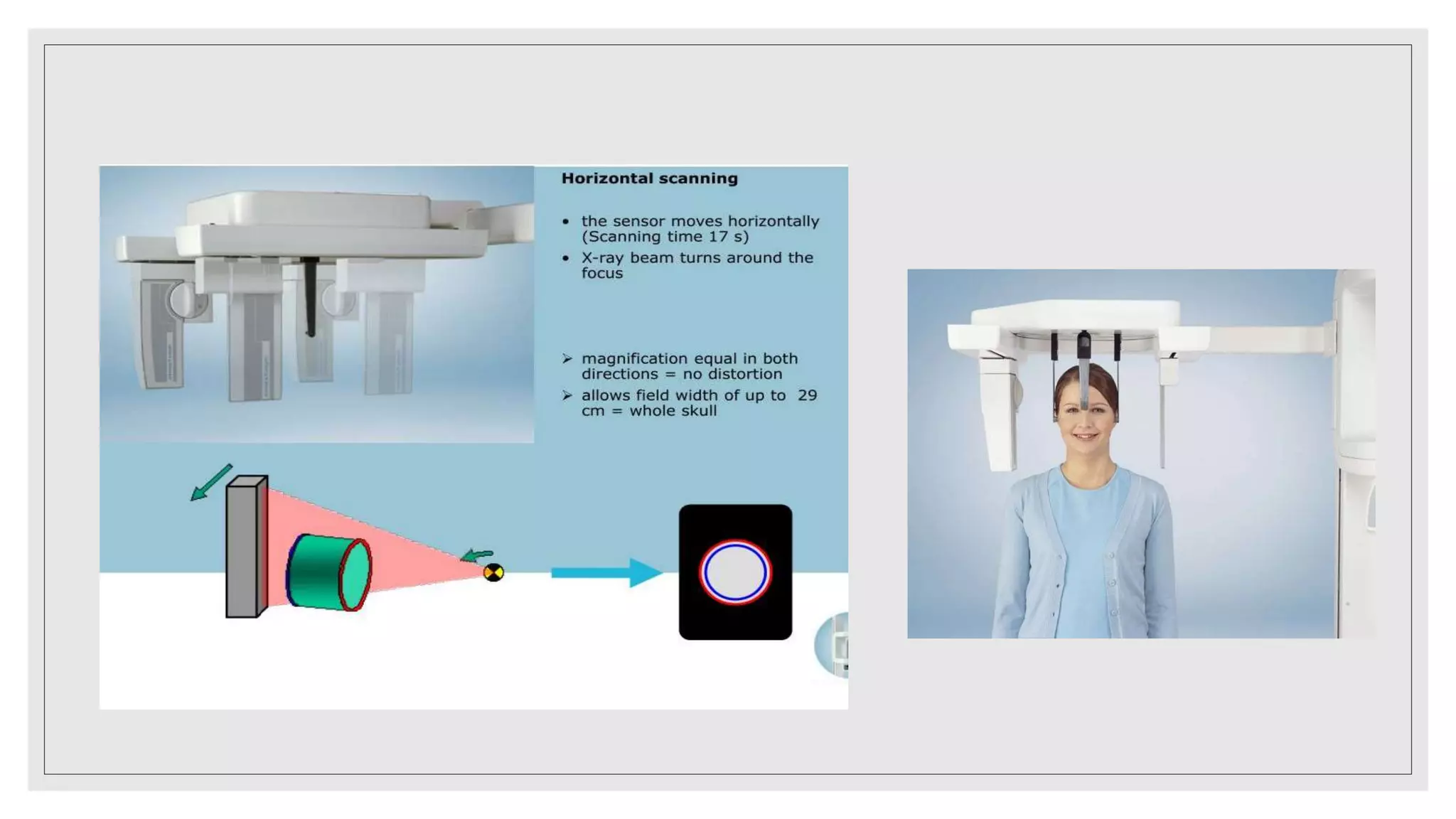 Digital cephalometry | PPTX