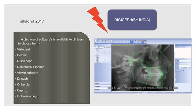 Digital cephalometry | PPTX