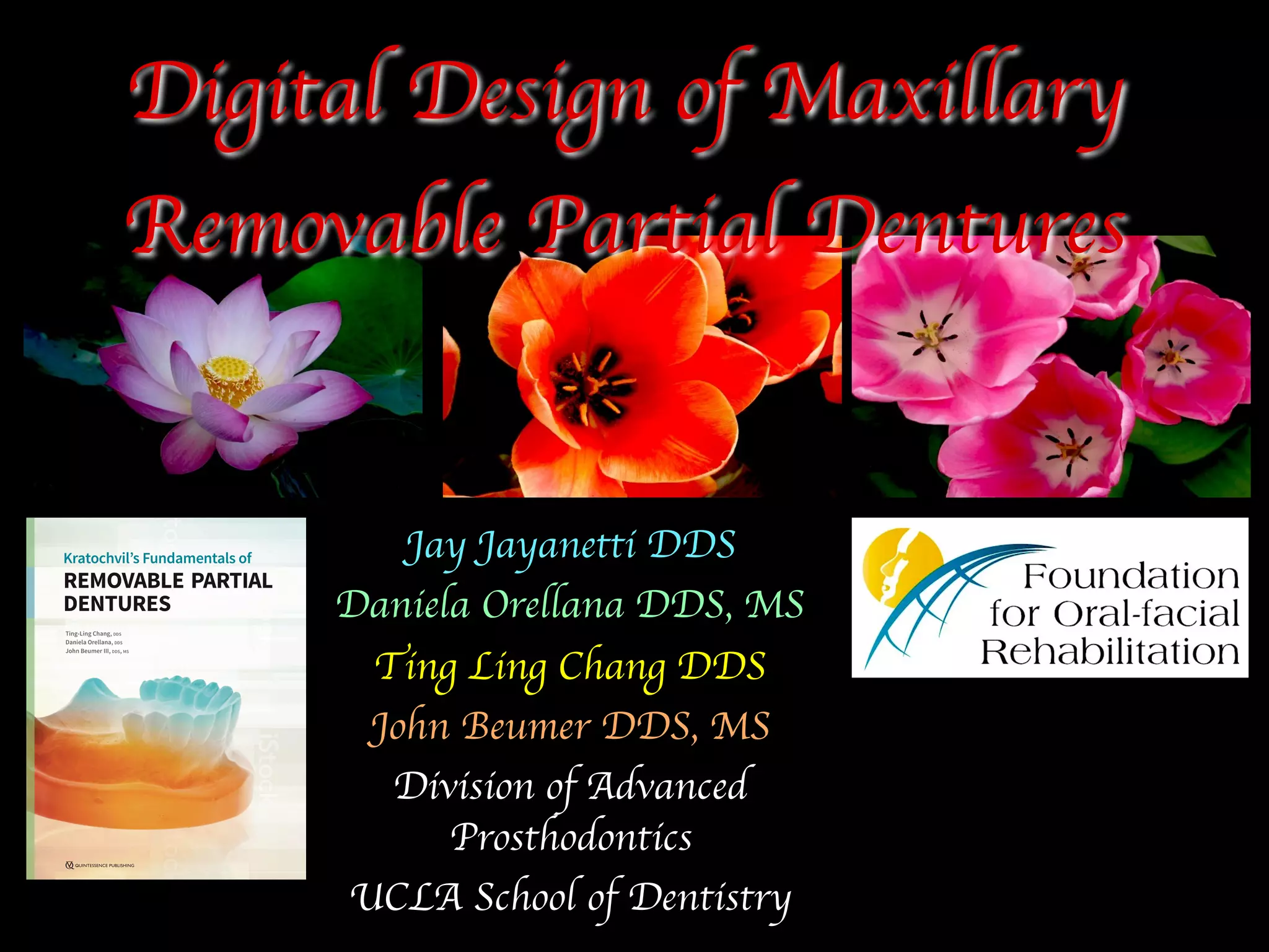 Digital design of maxillary of rpd's | PDF