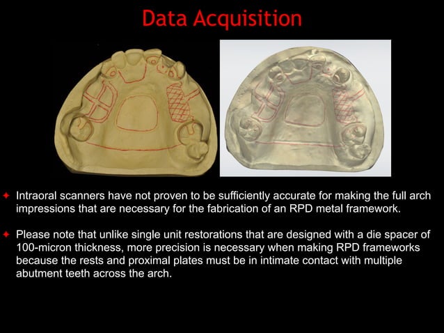 Digital design of maxillary of rpd's | PDF