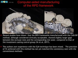 Digital design of maxillary of rpd's | PPT