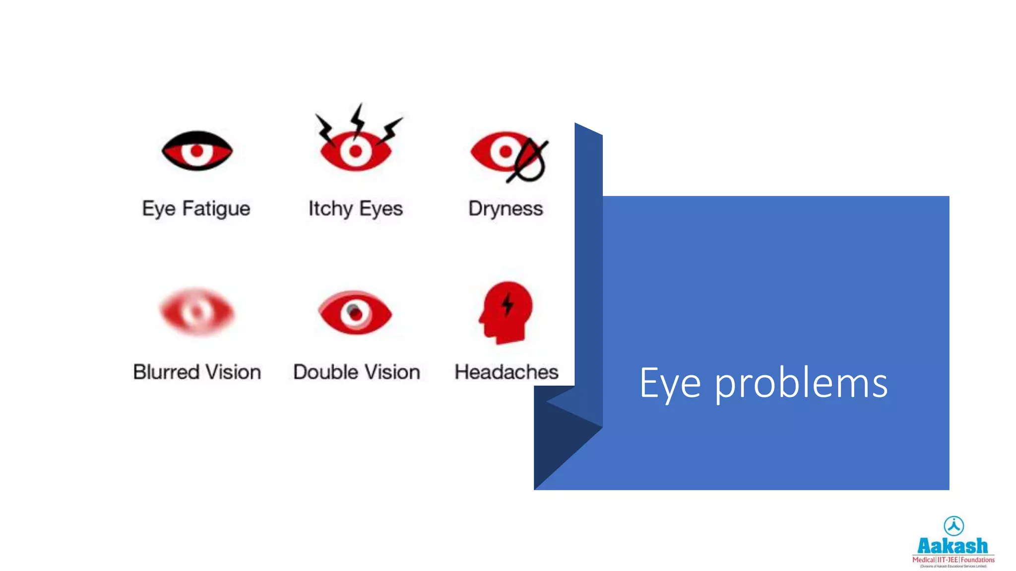 Digital eye strain - Computer vision syndrome for students during ...