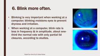 Digital eye strain | PPSX