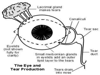Eye Strain Diagram