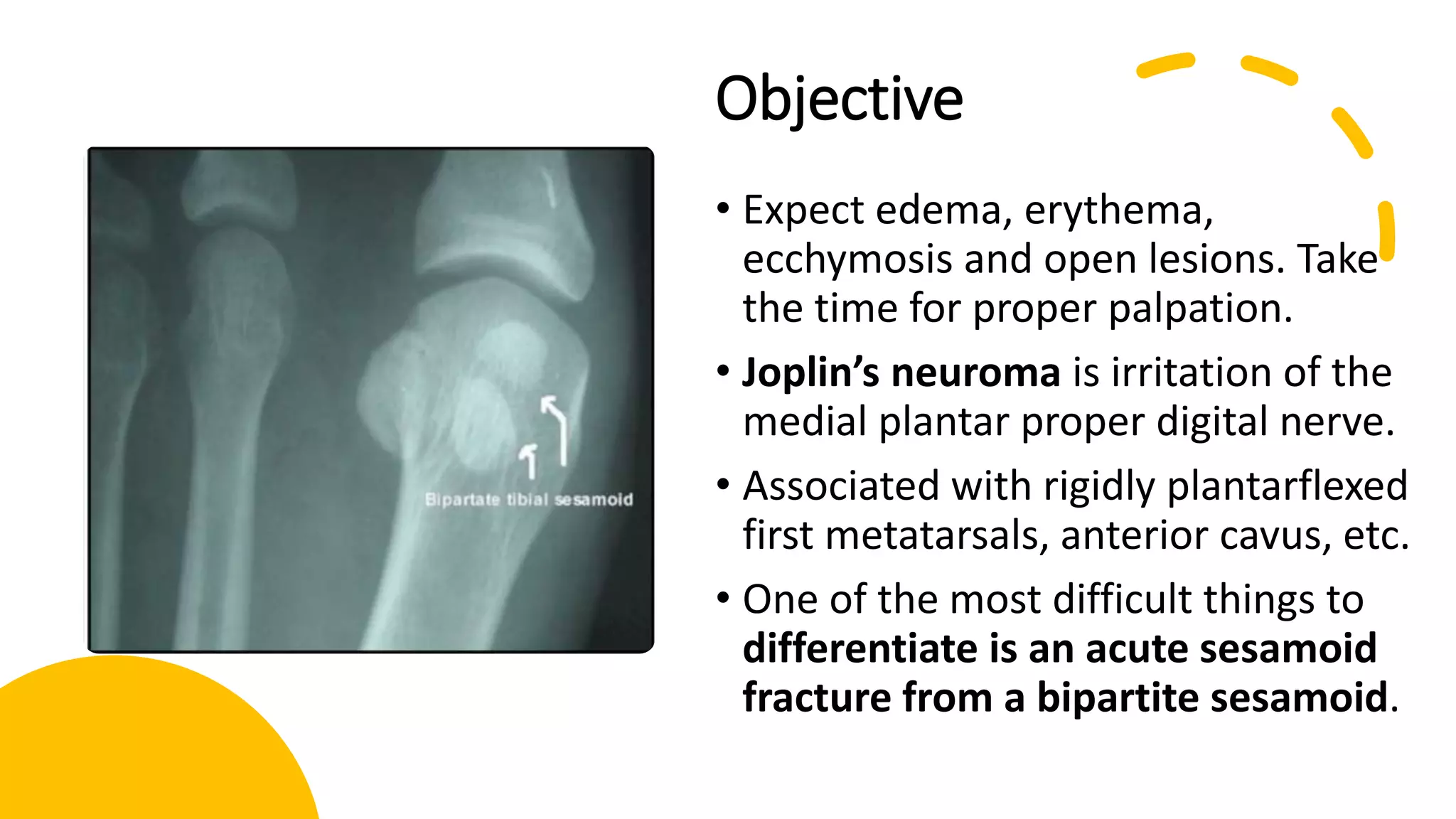 AJM Sheet: Digital fracture | PPT
