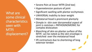 AJM Sheet: Digital fracture | PPTX