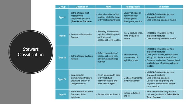 AJM Sheet: Digital fracture | PPT