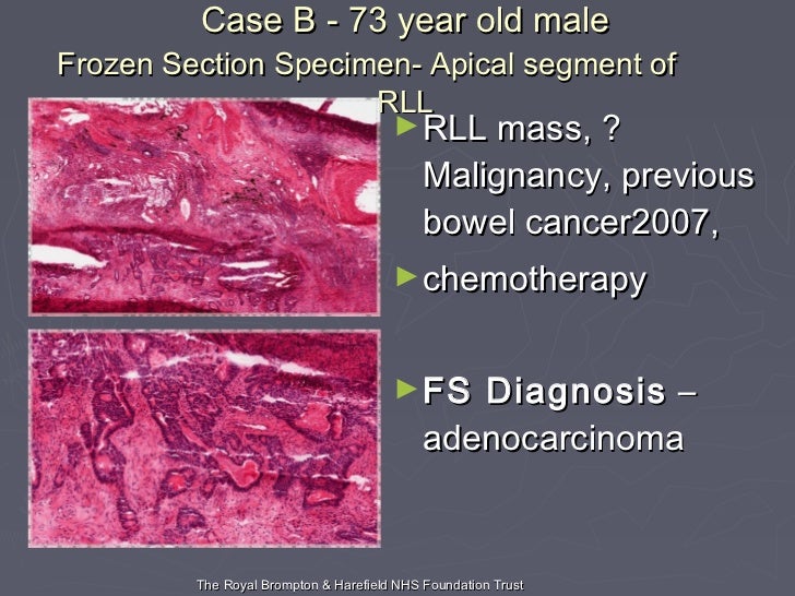 Digital Frozen Section Pathology Acp Manchester 2012