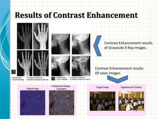 Digital Image Communication and Enhancement | PPTX