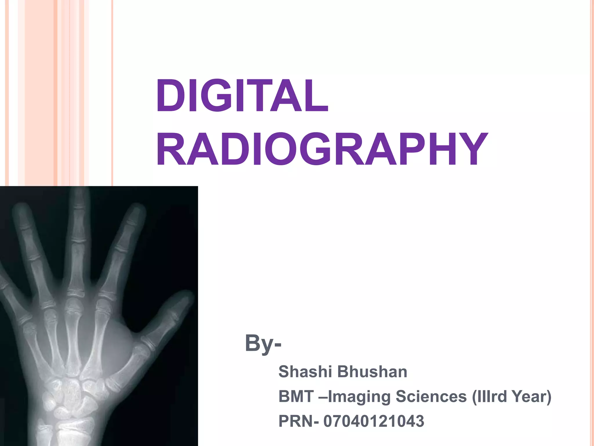 computed and digital radiography(2) | PPTX